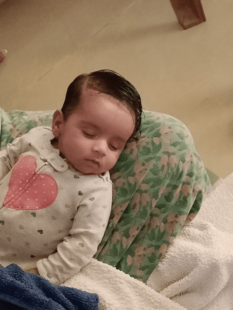 Frontal Bossing Infant